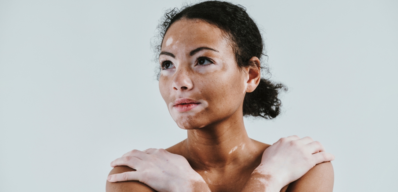 Depigmentation Skin Mask: Achieve Radiant, Even Skin Tone